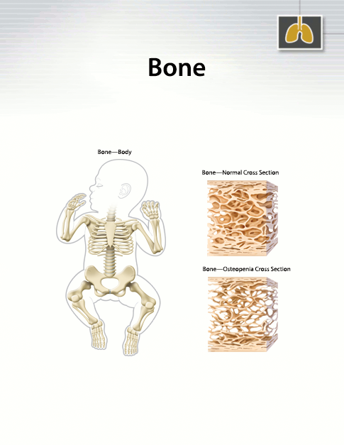 Bone - NICU Parent Education Resources